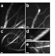 Device Captures Deep-Tissue Brain Images | News & Features | Aug 2005 ...