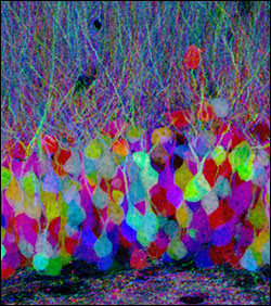 Neurons Glow in 'Brainbow' | News & Features | Nov 2007 | BioPhotonics