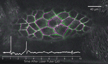 Research probes physical mechanics of laser energy in living tissue ...