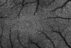 Imaging Macular Degeneration | News & Features | Feb 2009 | Photonics ...