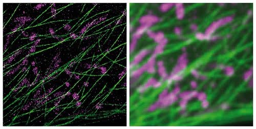 Imaging Platform Improves Limited Resolution Abilities of Single ...