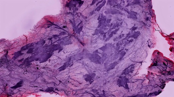 Hybrid Microscope Optics Push the Limits of 3D Tissue Imaging ...