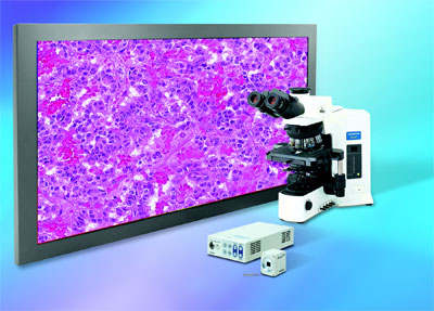 Toshiba HD Clinical Microscopy | CANON MEDICAL COMPONENTS U.S.A., Video ...