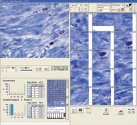 Tuberculosis Detector | Applied Spectral Imaging Inc ...