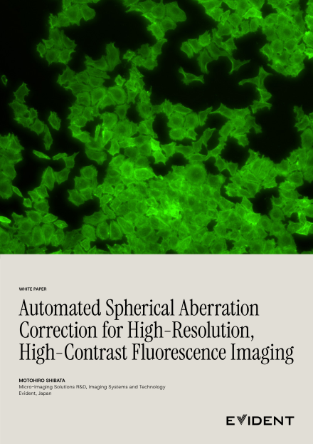 Automated Spherical Aberration Correction for High-Resolution, High ...